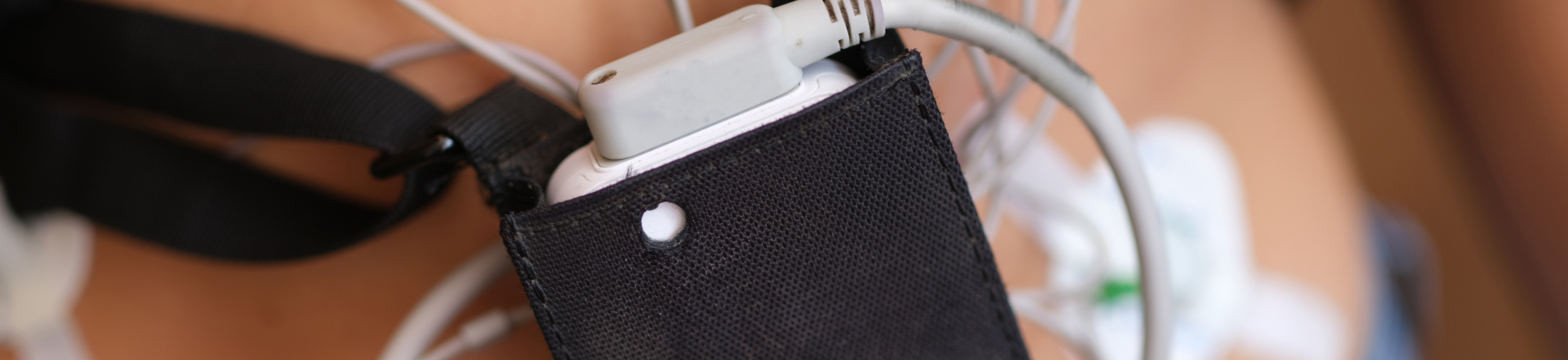 3 Challenges of Patient Monitoring